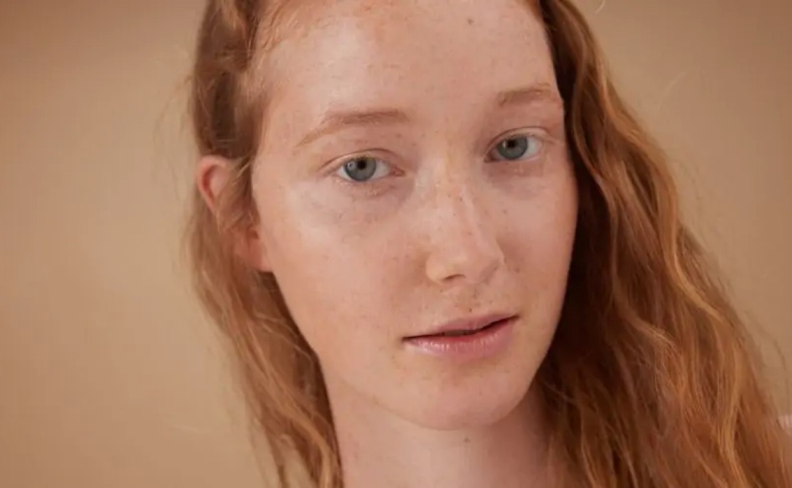 Comment atténuer les rougeurs sur le visage ? - Beauty Therapy