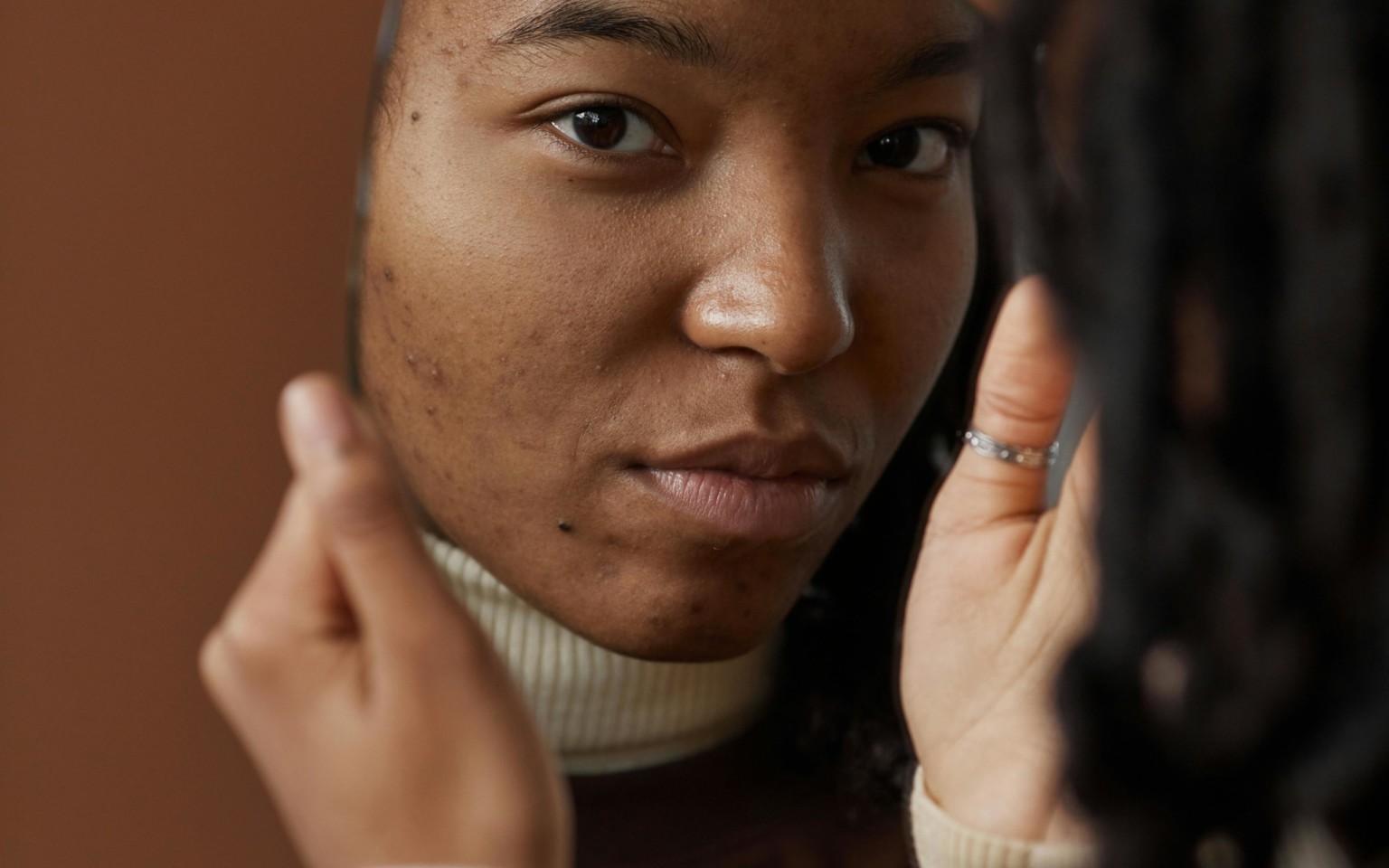 Boutons sur le visage : causes et solutions - Beauty Therapy